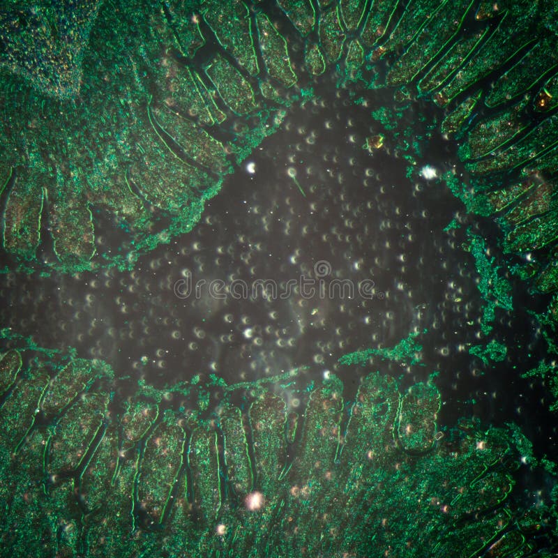 Micrograph of Small Intestinum Stock Image - Image of macro, physiology ...