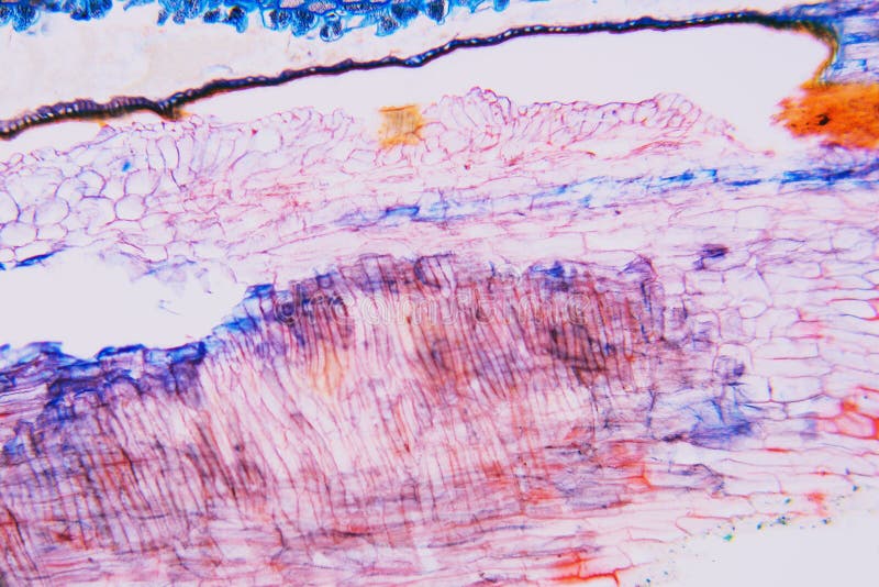 Micrographe microscopique photo stock. Image du section - 85551128