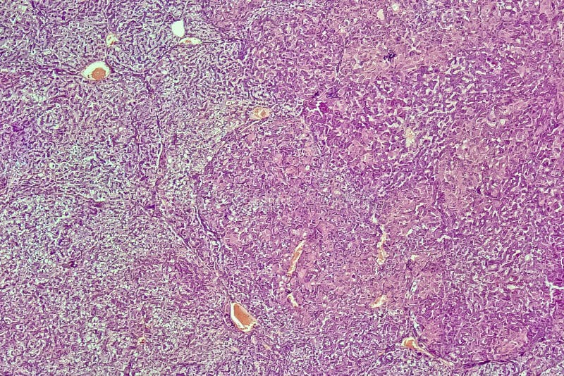 Microscope Photo of a Section through a Rat Liver, 60x Zoom Stock Photo ...