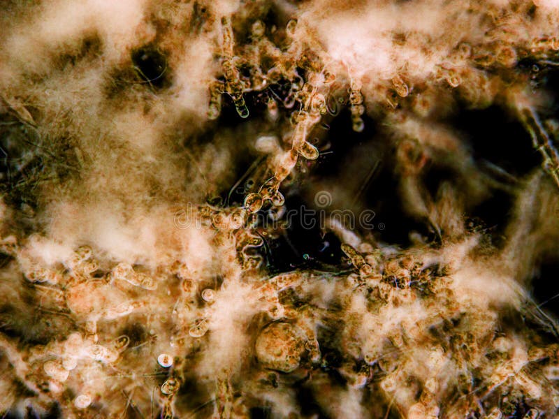 Microorganism or Virus Cells, Algae Microorganism Cells Under ...