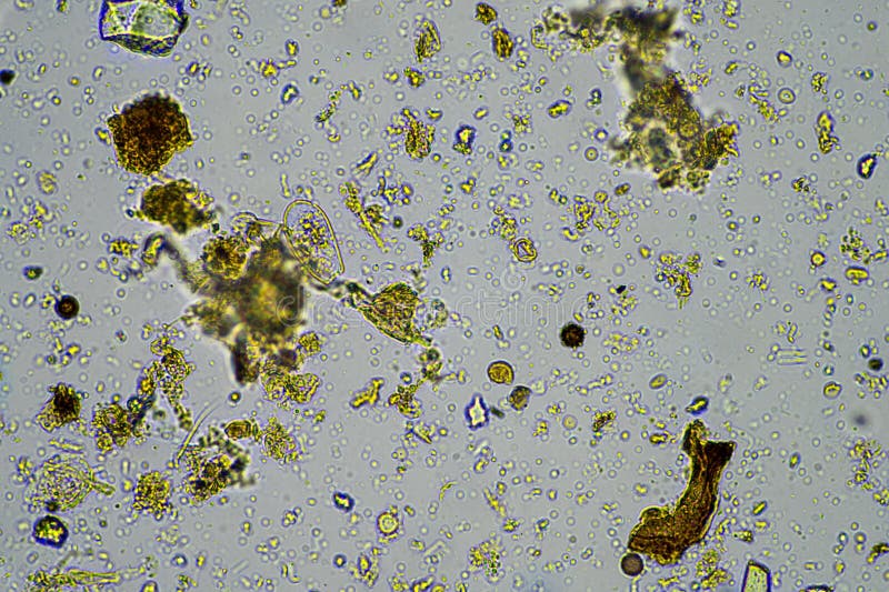 Microorganisms and Biology in Compost and Soil Sample Under the ...