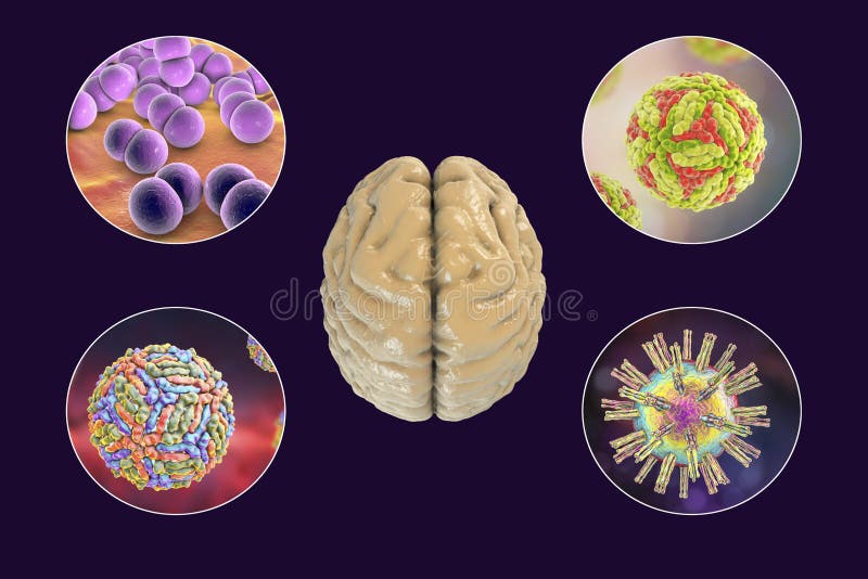 Microorganisms that Cause Brain Infections Stock Illustration ...