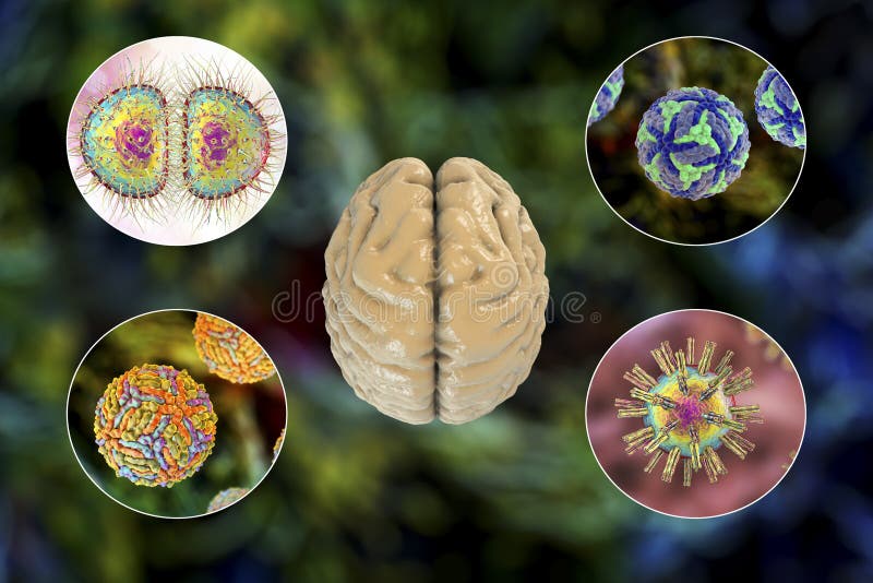 Microorganisms that Cause Brain Infections Stock Illustration ...