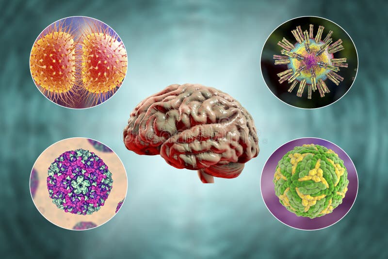 Microorganisms that Cause Brain Infections Stock Illustration ...
