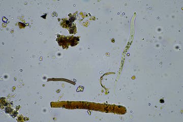 Moss Spores Microscope Stock Photos - Free & Royalty-Free Stock Photos ...