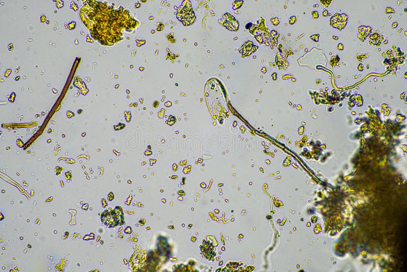 Microorganisms and Soil Biology, with Nematodes and Fungi Under the ...