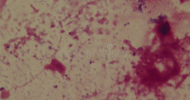 Bacteria Under a Microscope in a Hospital Stock Footage - Video of ...