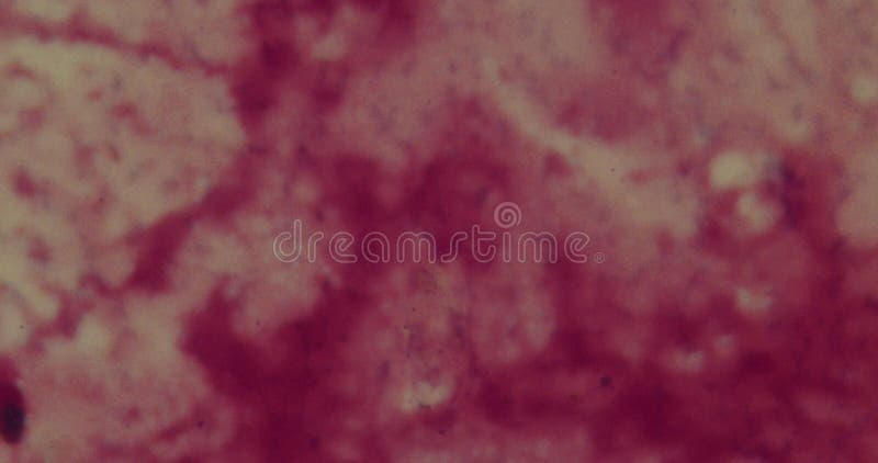 Bacteria Under a Microscope in a Hospital Stock Video - Video of asian ...