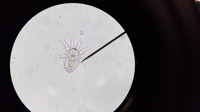 Microscope stock image. Image of findings, organism - 102217897