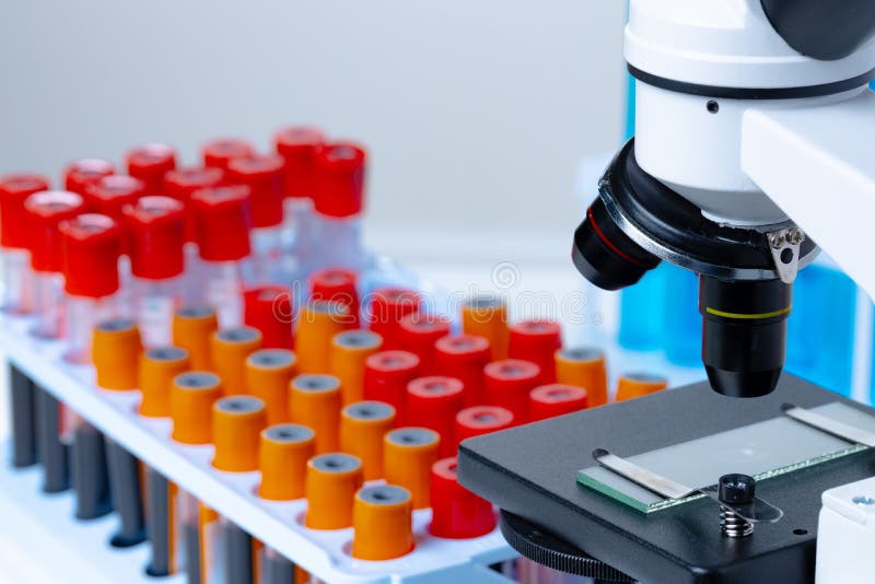 Microscope with Blood Samples Test Tubes Close Up Stock Photo - Image ...