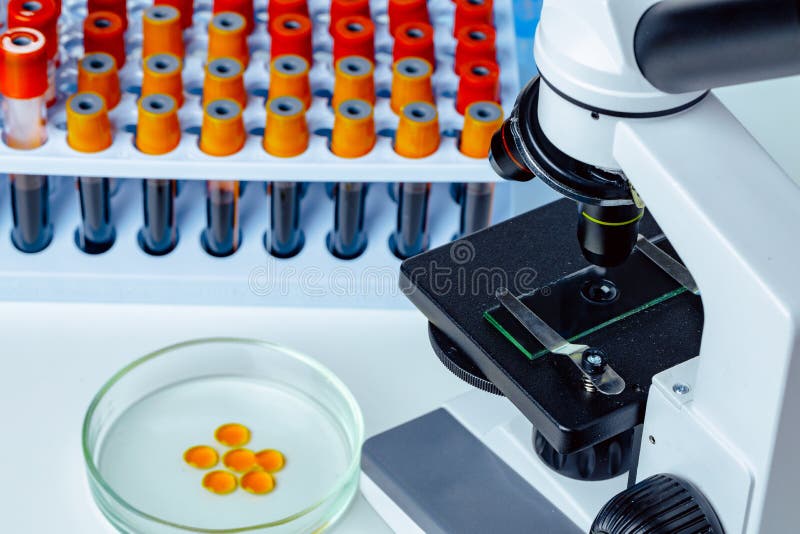 Microscope with Blood Samples Test Tubes Close Up Stock Image - Image ...