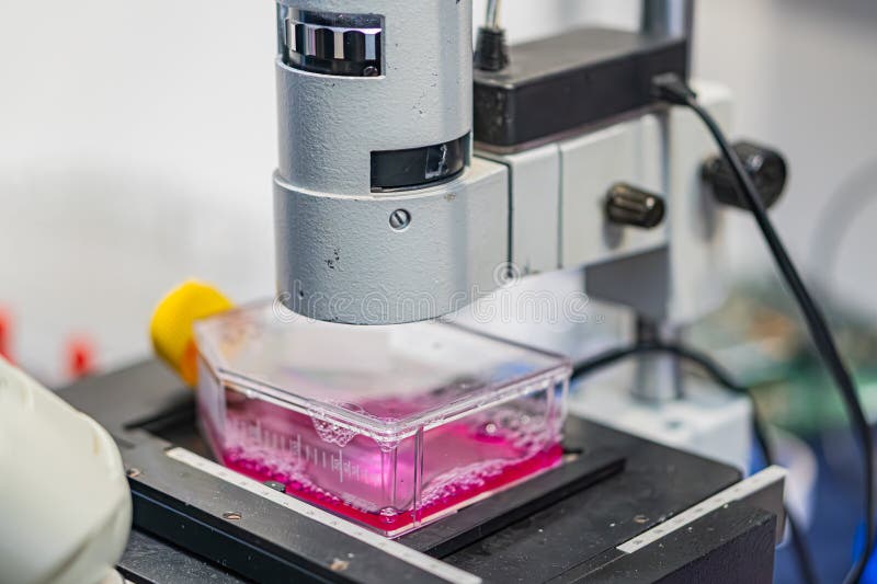 Microscope with a Cancer Cell Preparation in a Scientific Laboratory ...