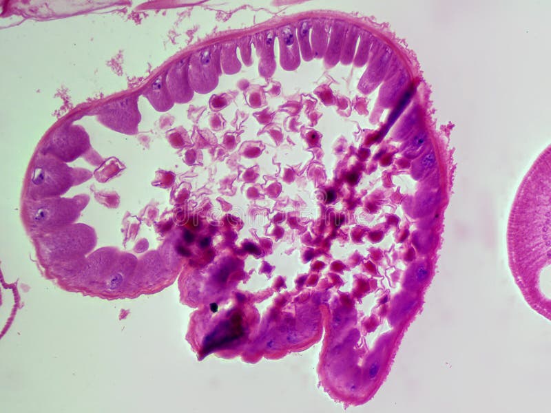 Histology Microscope Image of Female Ascaris Roundworm Uterus with Eggs ...