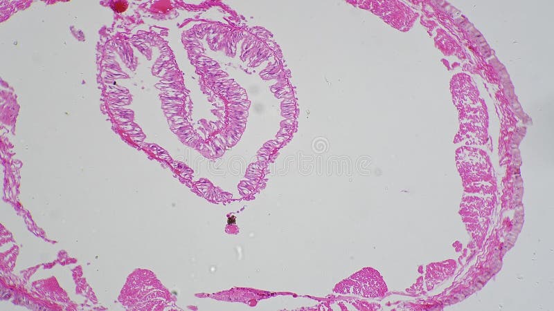 Earthworm Cut in Transversal Section and Magnified in 200 Times Under ...
