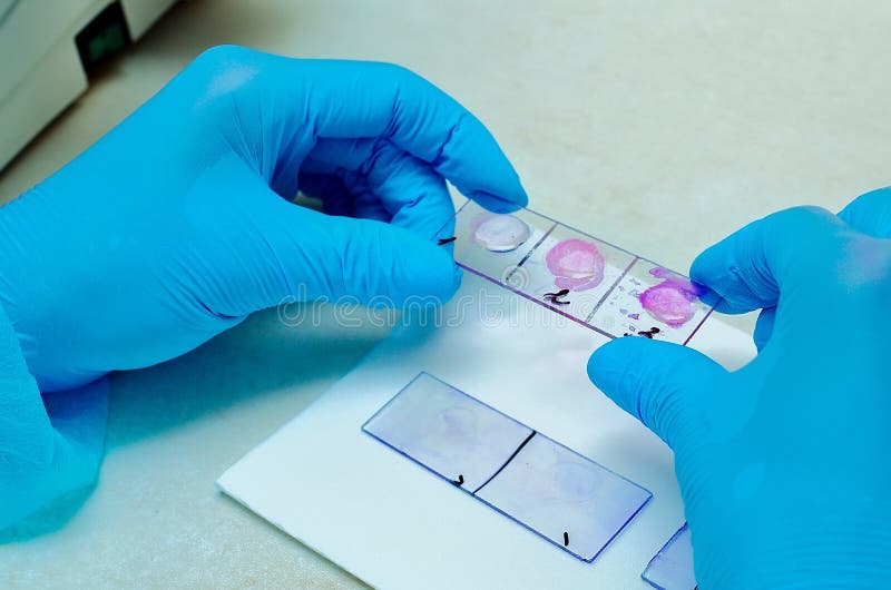 Microscope. Microbiological Laboratory. Mold and Fungal Cultures ...