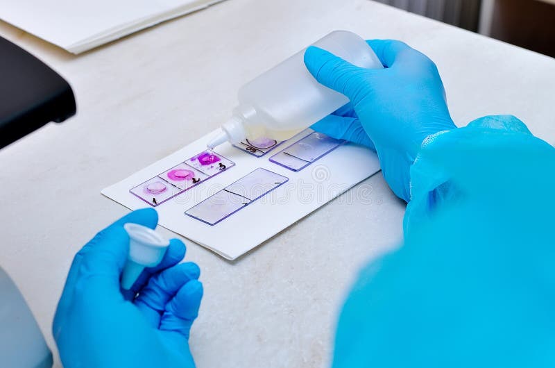 Microscope. Microbiological Laboratory. Mold and Fungal Cultures ...
