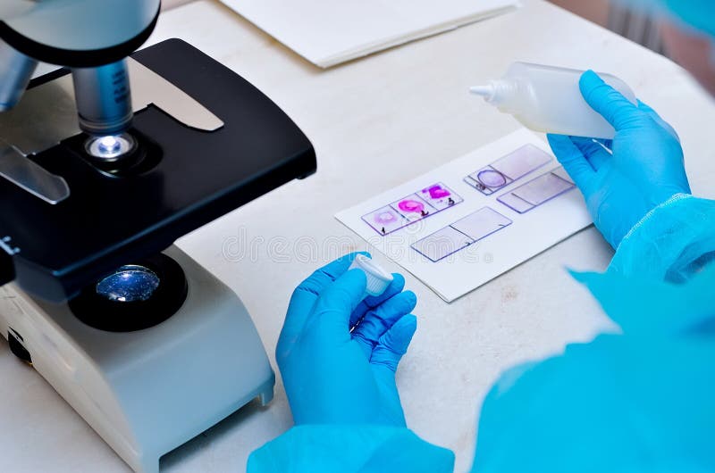 Microscope. Microbiological Laboratory. Mold and Fungal Cultures ...