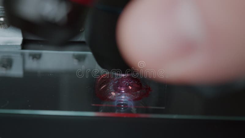 Microscope with Optical Lens Examining Blood Sample Stock Footage ...