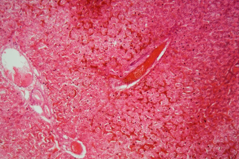 Liver Cells Under the Microscope Stock Photo - Image of health ...