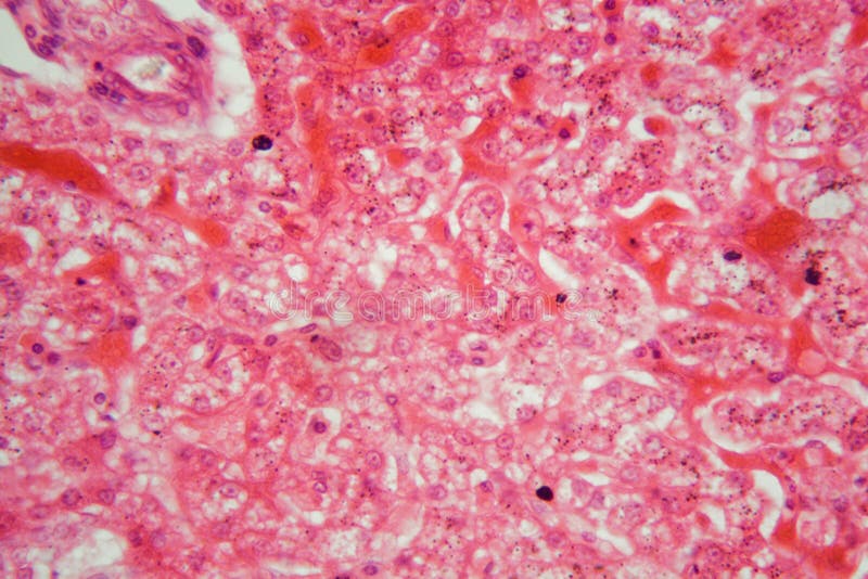 Liver Cells Under the Microscope Stock Photo - Image of cellular ...