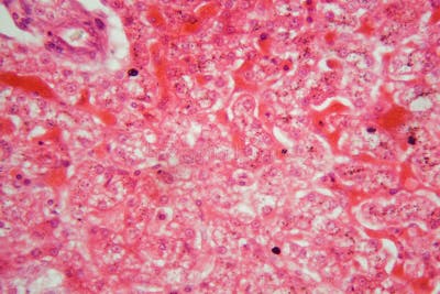 Liver Cells Under the Microscope Stock Photo - Image of cellular ...