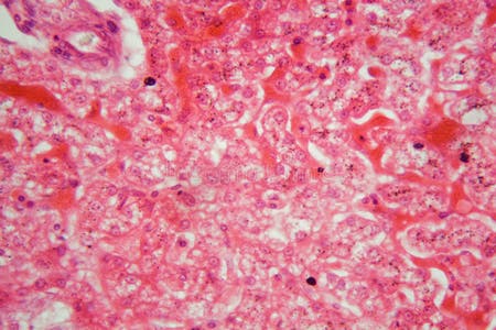 Liver Cells Under the Microscope Stock Photo - Image of cellular ...