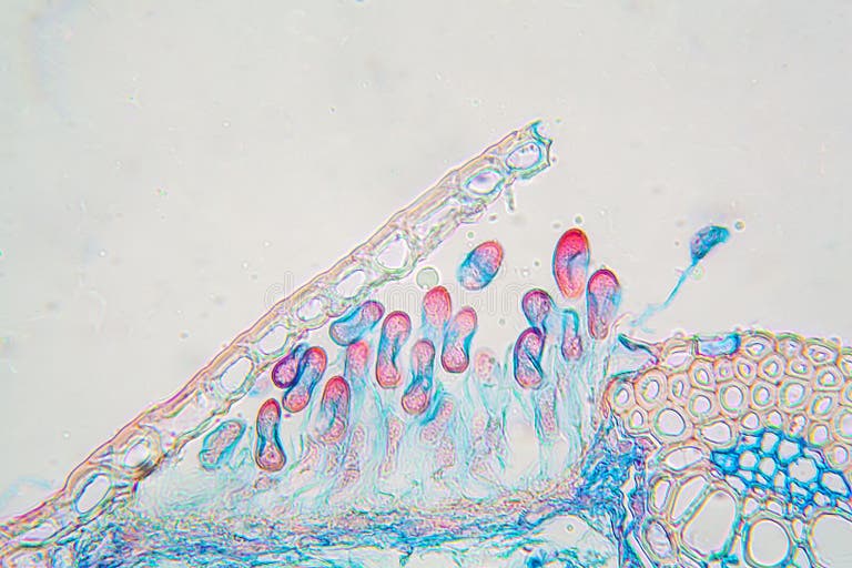 Microscope Photo of Steam Rust, Puccinia Graminis Stock Image - Image ...