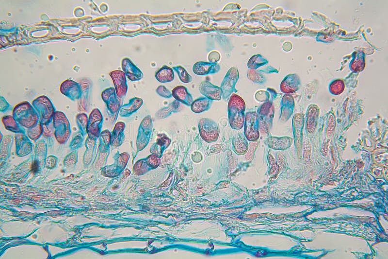 Microscope Photo of Steam Rust, Puccinia Graminis Stock Image - Image ...