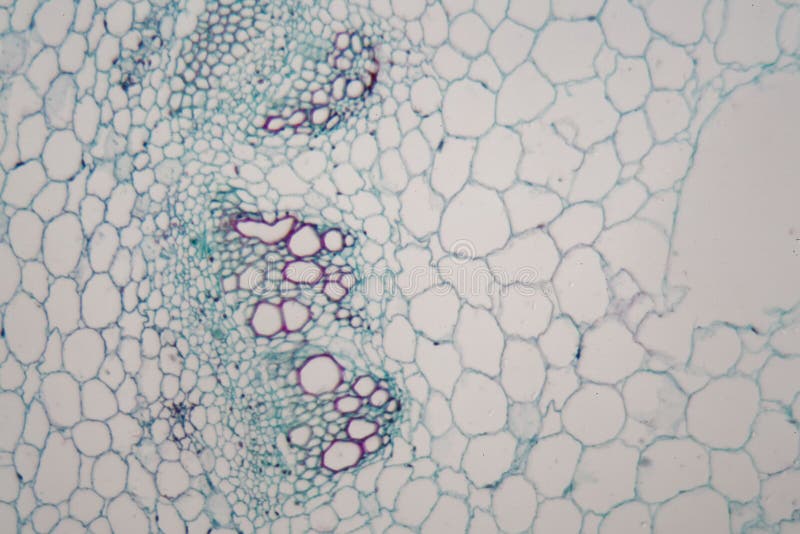 Microscope Photo of a Sunflower Stem. Stock Photo - Image of anatomy ...