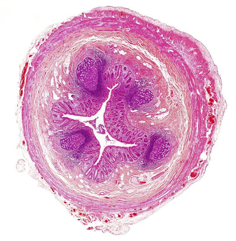 Microscope Picture of Human Appendix Stock Image - Image of ...
