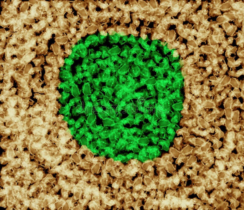 Microscope Picture of the Virus Stock Illustration - Illustration of ...