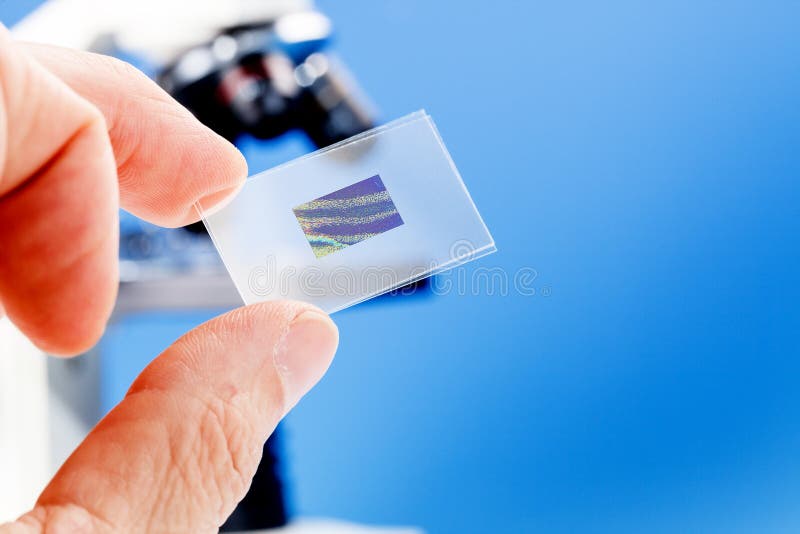 Dropped Blood Onto Microscope Slide 1 Stock Photo - Image of drop ...
