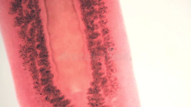 Flatworm slide stock video. Video of slide, flukes, crawling - 237521413