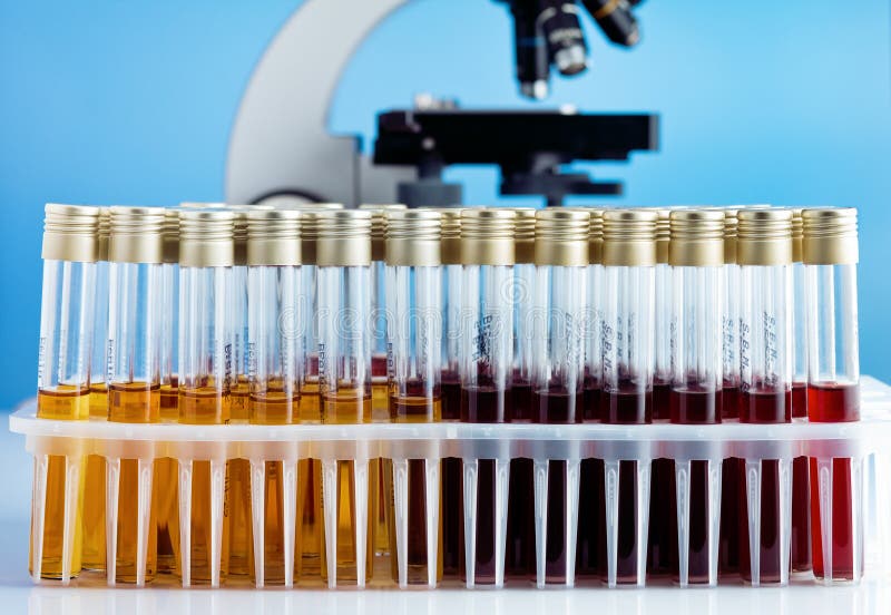 Microscope and Tubes with Liquid Medium in Laboratory Stock Photo ...