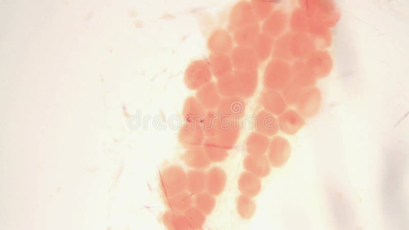 Microscope View of Adipose Tissue Stock Footage - Video of adipose ...