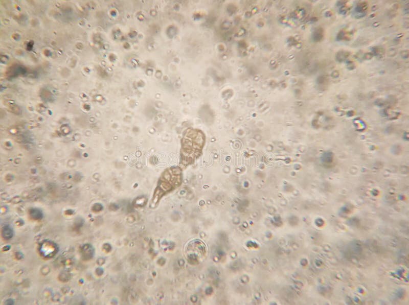 Microscopy of the Alternaria Fungus Macroconidia Stock Photo - Image of ...