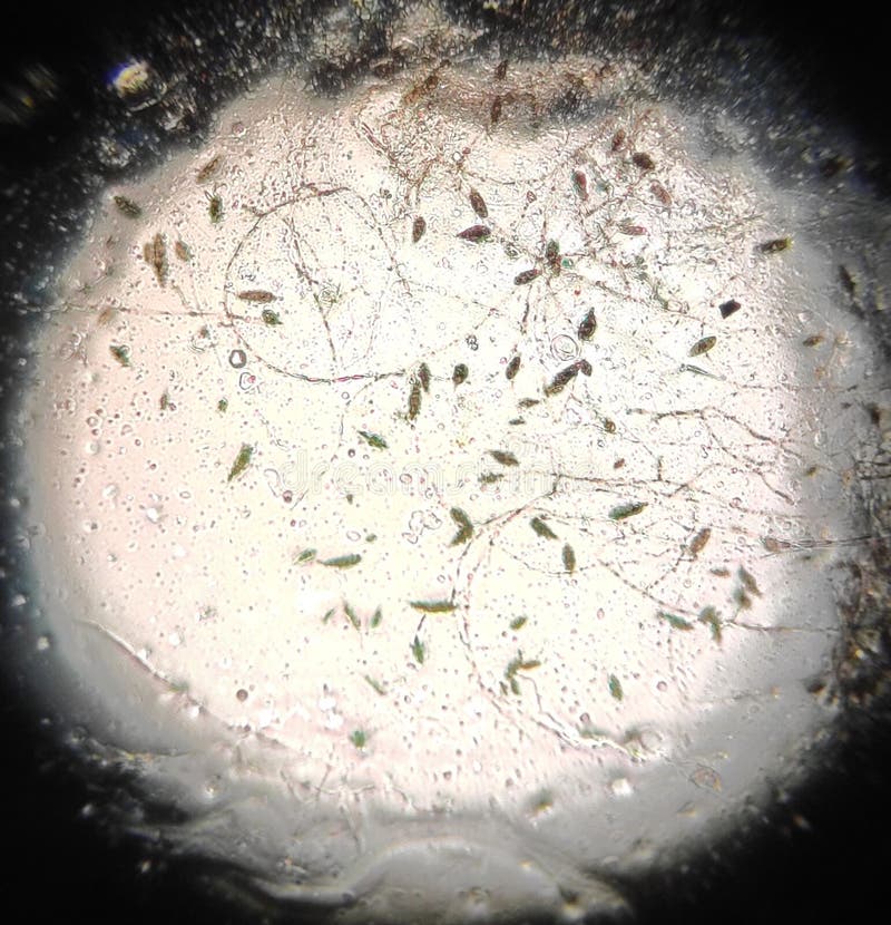 Alternaria Fungal Mycelium Under the Microscope Stock Photo - Image of ...