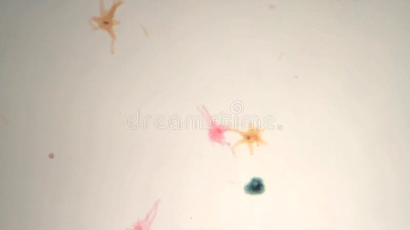 Microscope View of an Amoeba Stock Video - Video of slide, tentacular ...