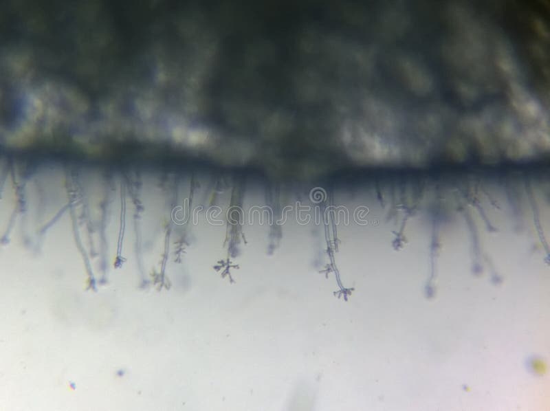 Microscope View of an Aspergillus Genus Mold Stock Photo - Image of ...