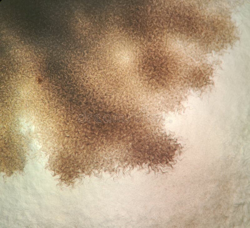 A Bacillus Genus Branched Bacterial Colony Under the Optical Microscope ...