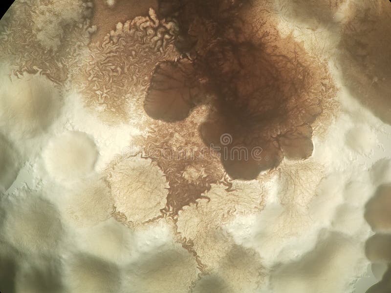 Microscope View of Bacteria Growing in Beautiful Fractal Pattern ...