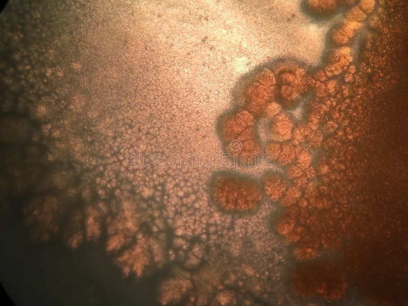 Microscope View of Bacteria Growing in Beautiful Fractal Pattern ...