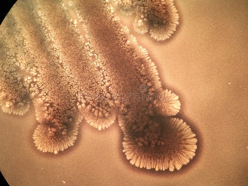 Microscope View of Bacteria Growing in Beautiful Fractal Pattern ...