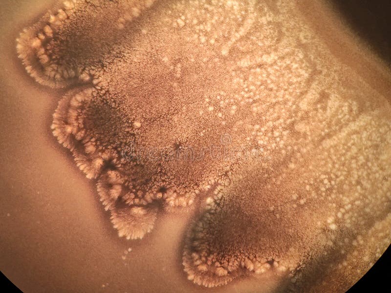 Microscope View of Bacteria Growing in Beautiful Fractal Pattern ...