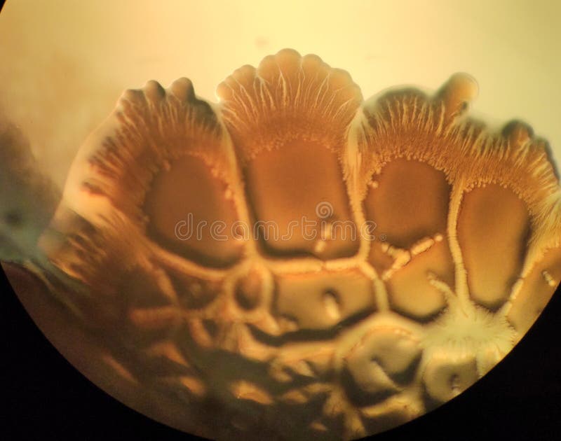 Bacterial Colonies Under the Microscope - Beautiful Growth Stock Image ...