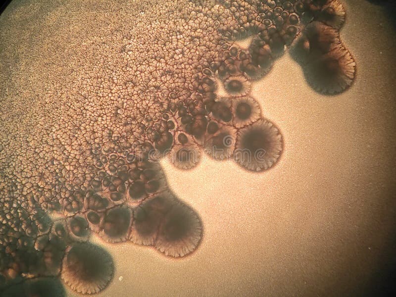 Microscope View of a Bacterial Colonies and Candida Albicans Stock ...