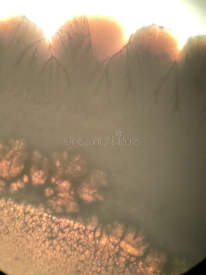 Microscope View Of Bacteria Growing In Beautiful Fractal Pattern ...