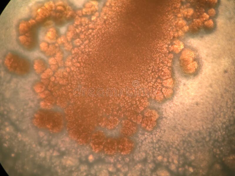 Beautiful Fractal Pattern Growth of a Bacterial Colony Under the ...