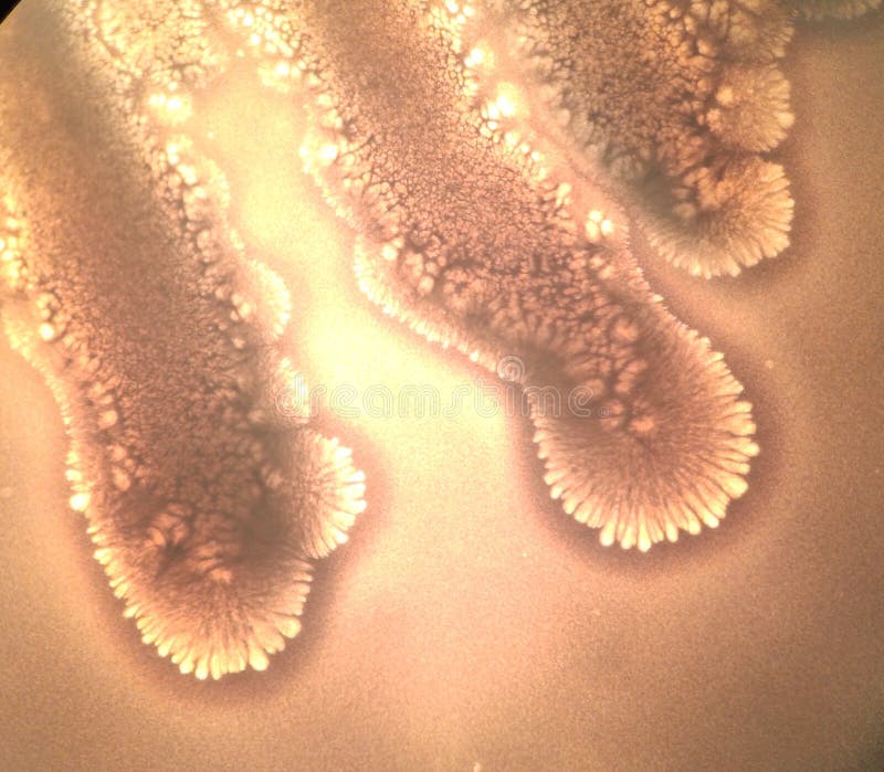 Microscope View of Bacteria Growing in Beautiful Fractal Pattern ...