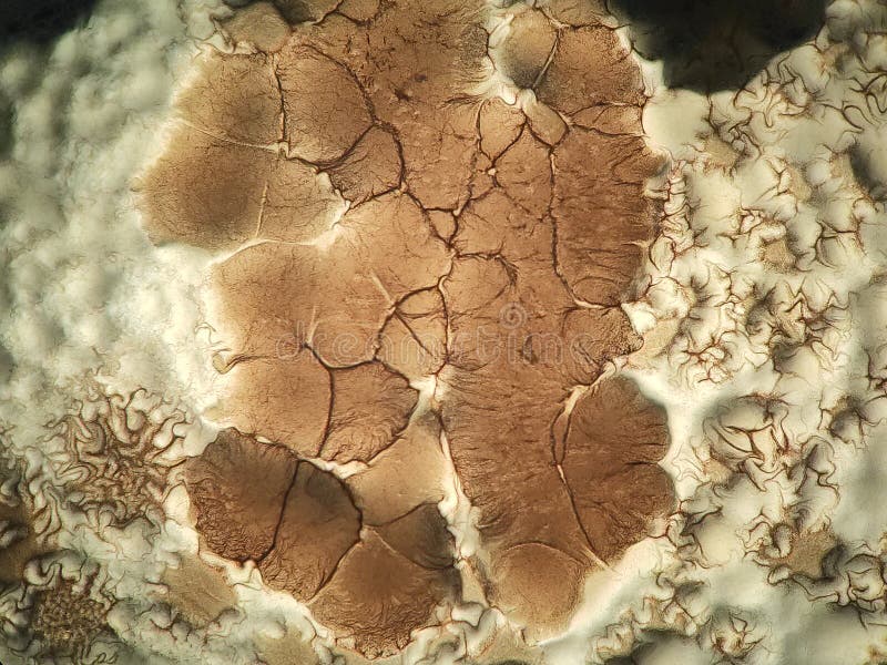 Beautiful Bacterial Colony Under the Microscope Stock Photo - Image of ...